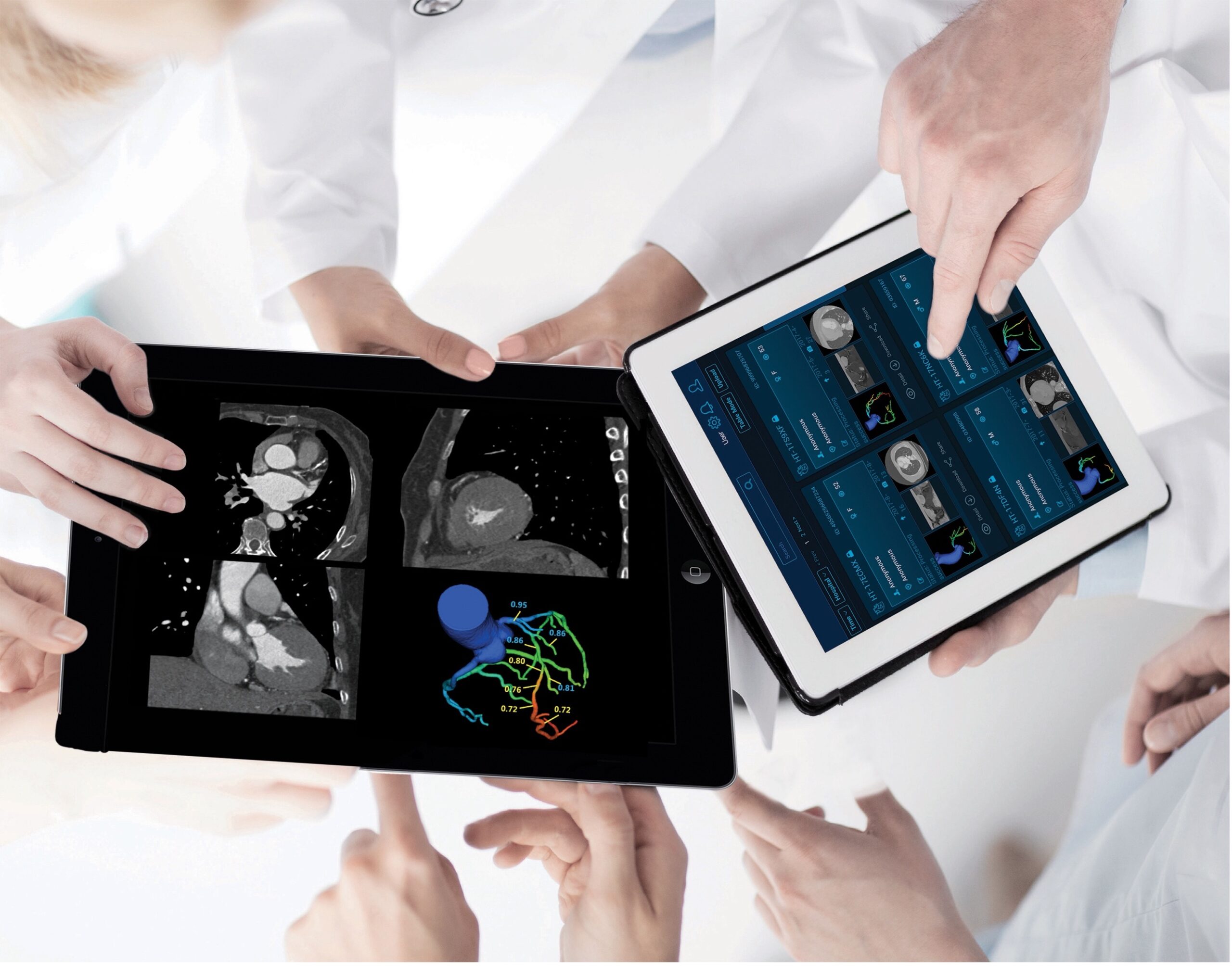 Corazon Imaging - KeyaMedical