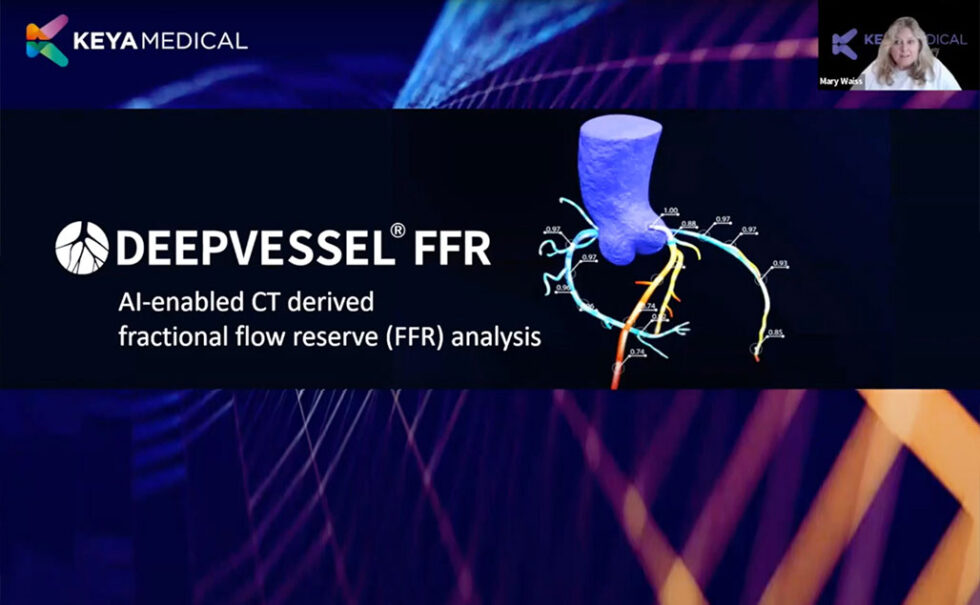 Enhancing Cardiovascular Care: The Story of DEEPVESSEL FFR by Keya ...