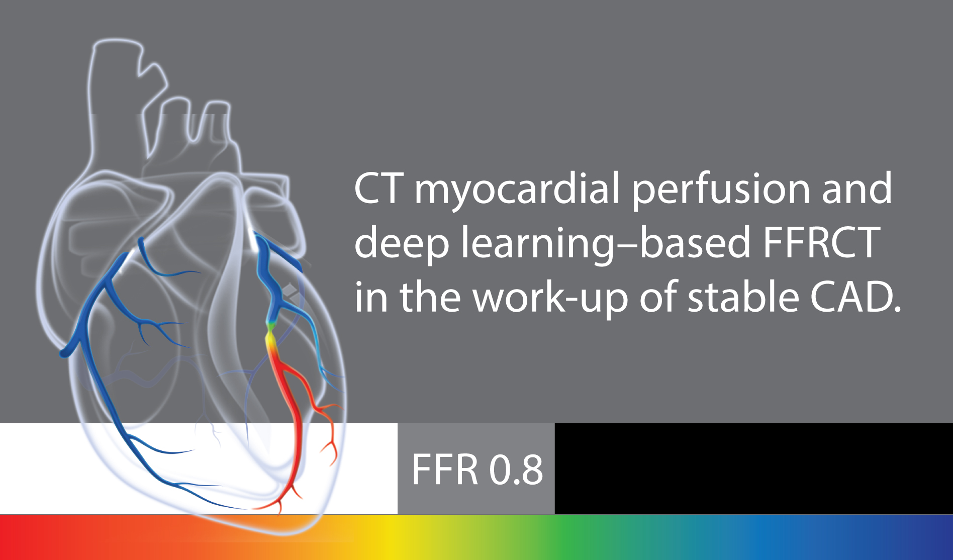 The Stepwise CCTA + FFRCT + CT-MPI Strategy: A Promising Approach for Evaluating Stenosis with ...